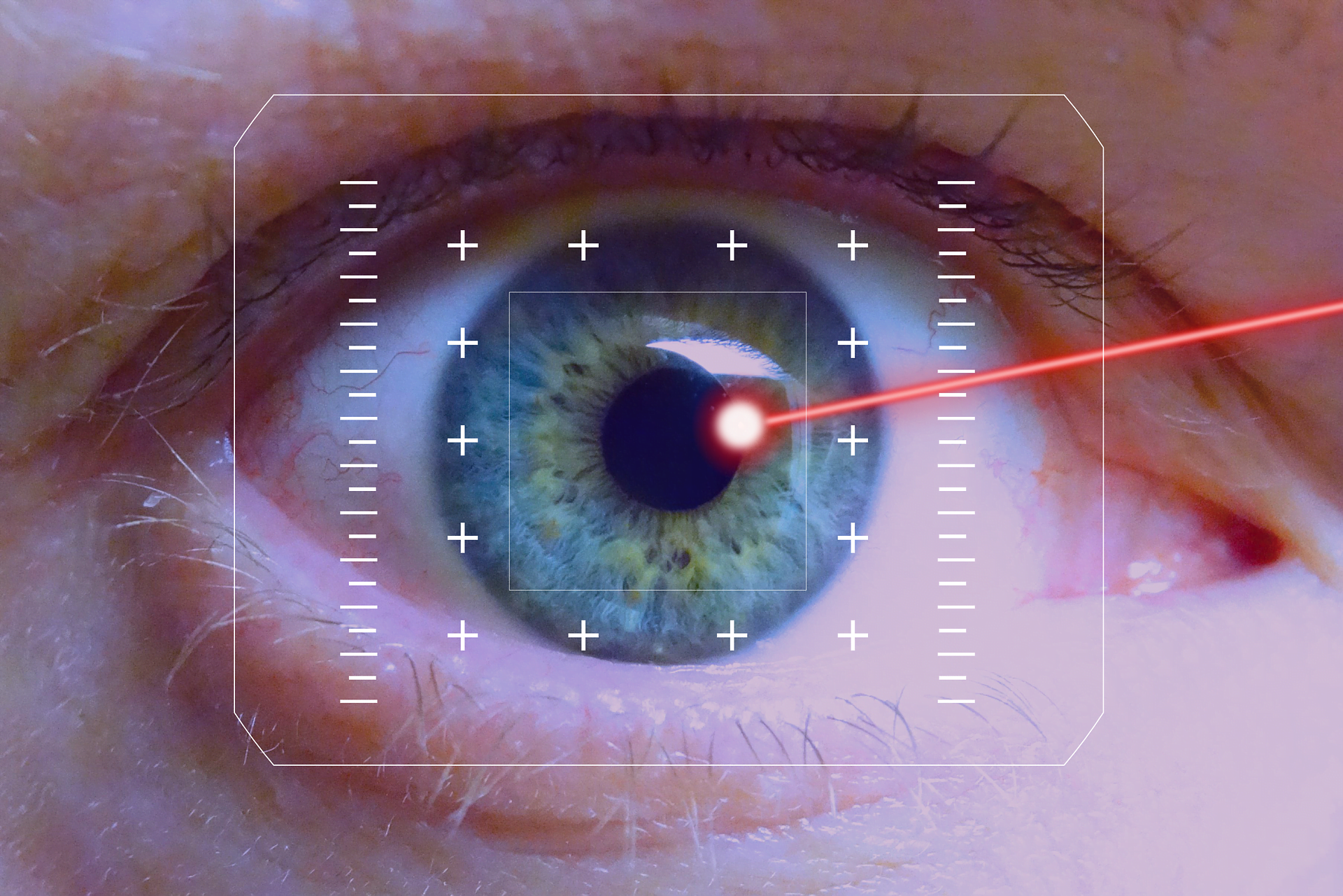 LASIK Eye Surgery: The Safest Vision Correction Procedure