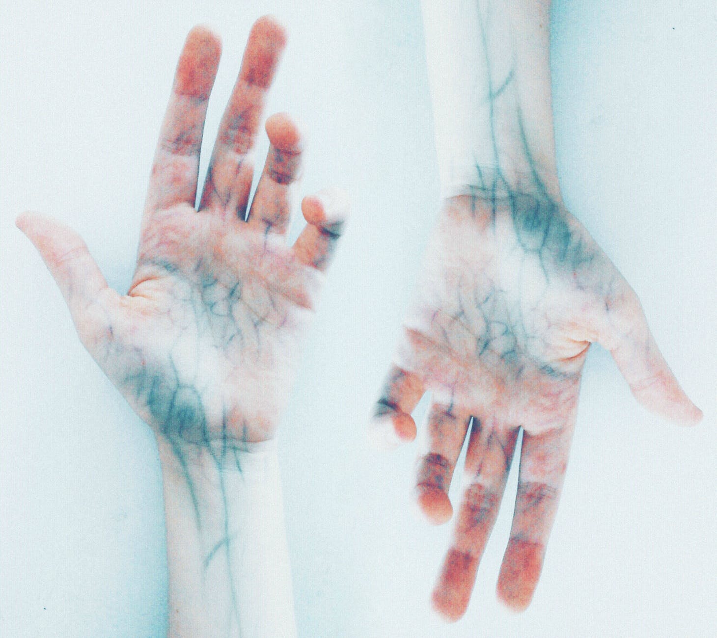 8 Proven Tips on Finding Difficult Veins - Health Works Collective