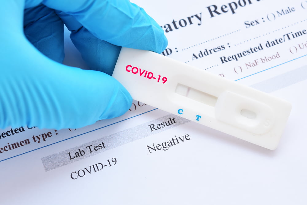 What You Should Know About the Lateral Flow Test for COVID-19