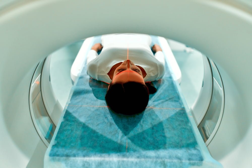 MRI Sedation Options: What You Should Know Before Screening