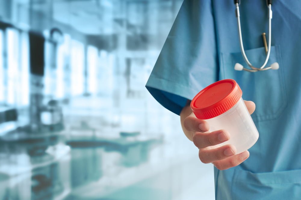 Importance of Specimen Cup Quality for Medical Tests